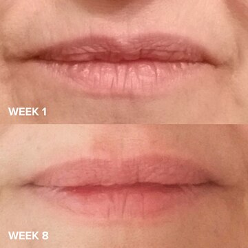 Hyaluronic Acid + Peptide Lip Treatment Booster | Paula's Choice Australia