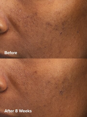 6% Mandelic Acid + 2% Lactic Acid Liquid AHA Exfoliant | Paula's Choice ...