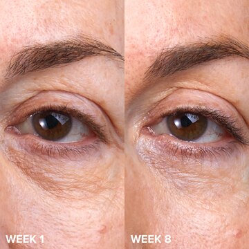 C5 Super Boost Eye Cream | Vitamin C Eye Cream | Paula's Choice Australia